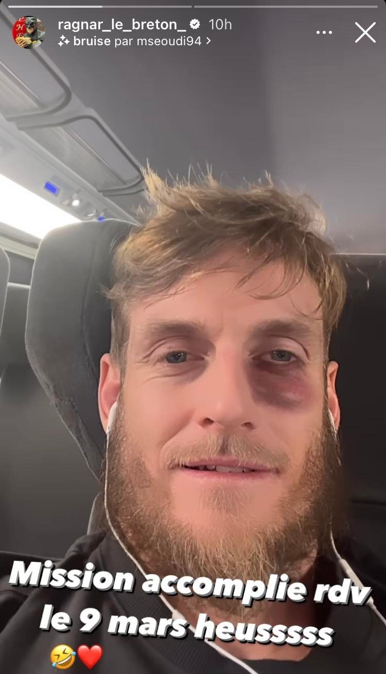 Ragnar Le Breton salement amoché pour son premier combat MMA ! (photo)