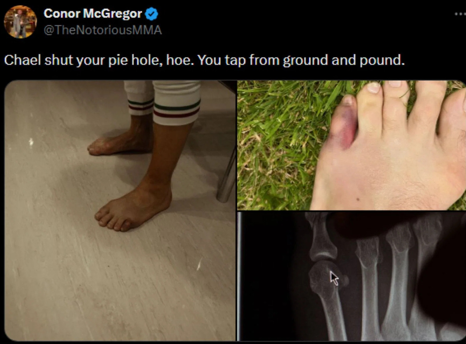 UFC - Conor McGregor poste des images de sa blessure, Islam Makhachev l ...